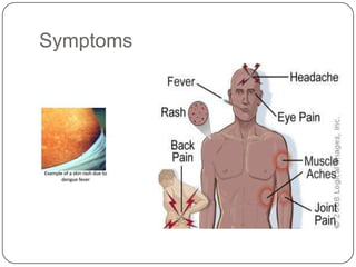 Dengue prevention | PPT