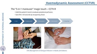 Dengue report management from mild to severe | PPTX