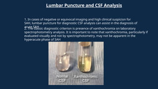Subarachnoid Hemorrhage, Management and treatment | PPTX