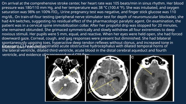 Subarachnoid Hemorrhage, Management and treatment | PPTX