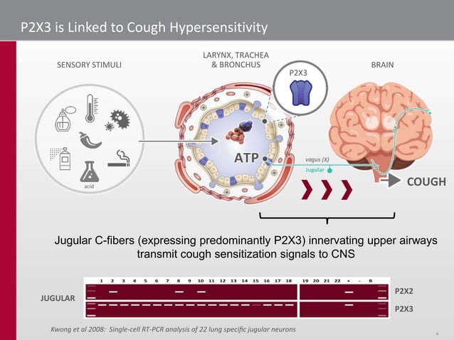 Denis garceau blu 5937 in chronic cough - cough conference | PPTX ...