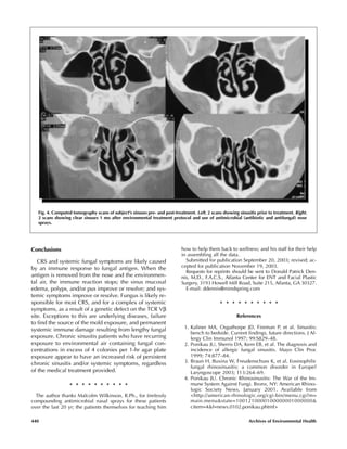 Dennis’s Chronic Sinusitis Article | PDF