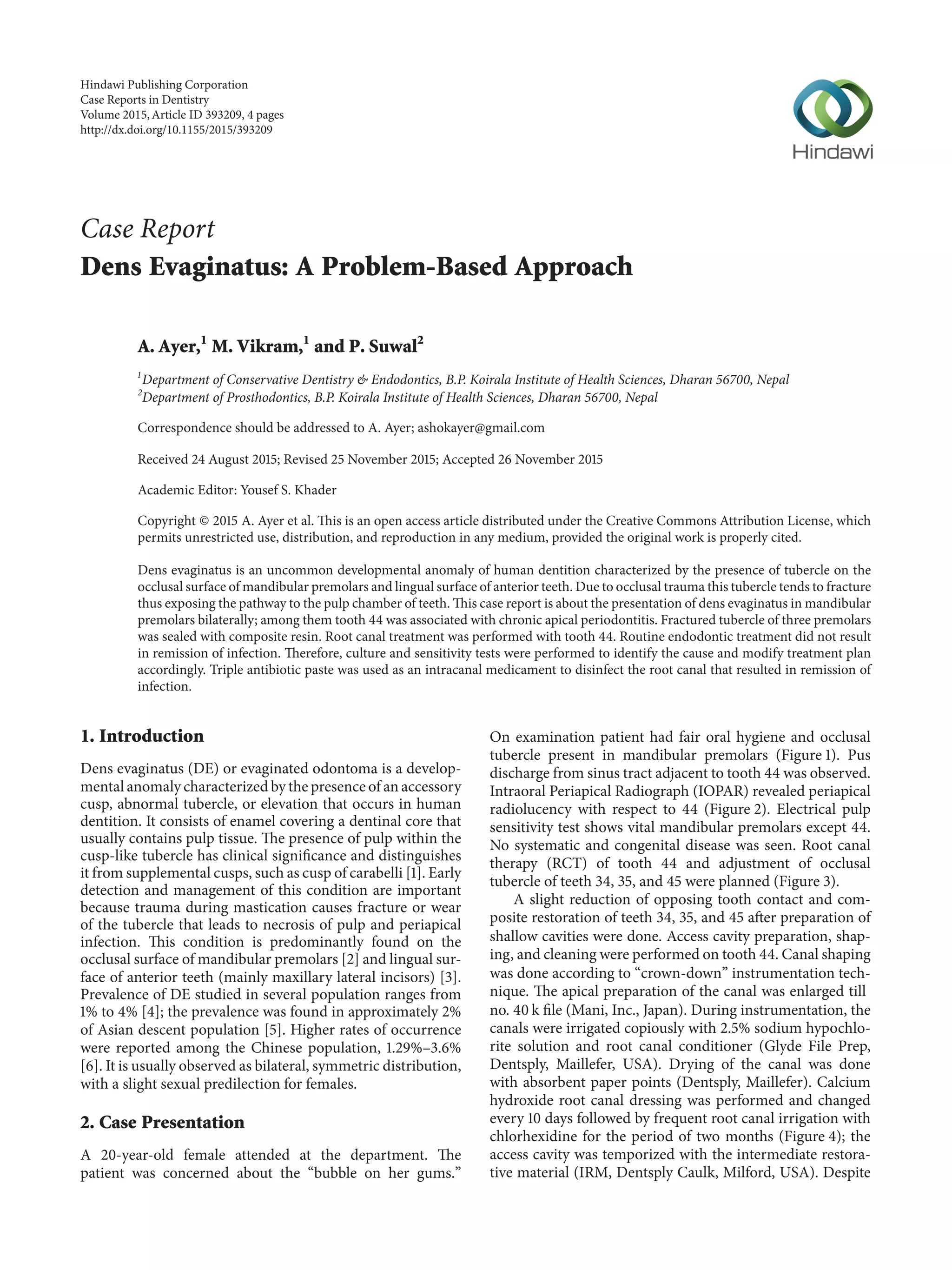 Dens evaginatus- a problem based approach | PDF