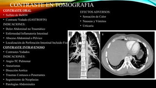DENSIDADES EN RADIOLOGIA - CONTRASTES.pptx