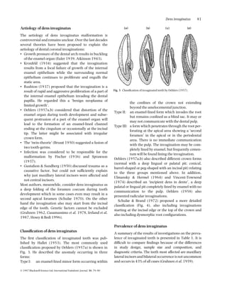 Dens invaginatus | PDF