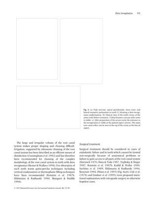 Dens invaginatus | PDF