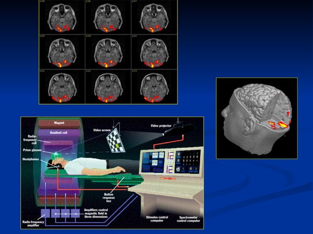 PET and SPECT Scanning: Functional Brain Imaging | PPT