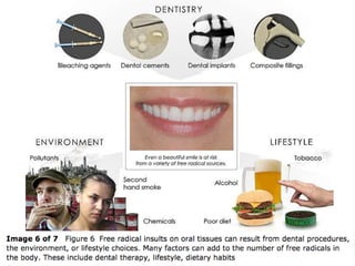 Dental Oxidative Stress & Protandim Presentation | PPT