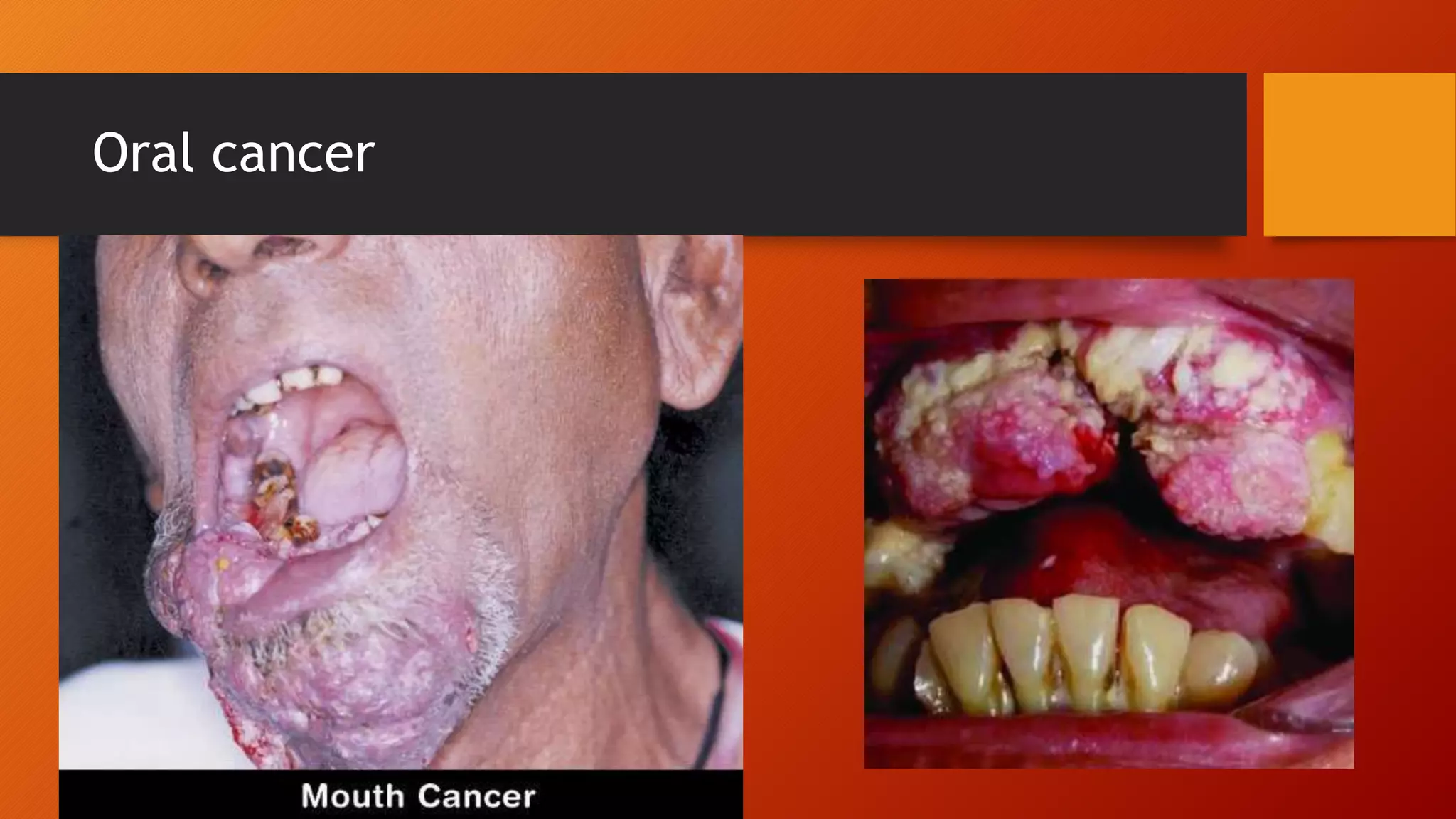 Dental-Awareness.pptx