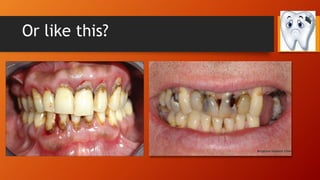 Dental-Awareness.pptx