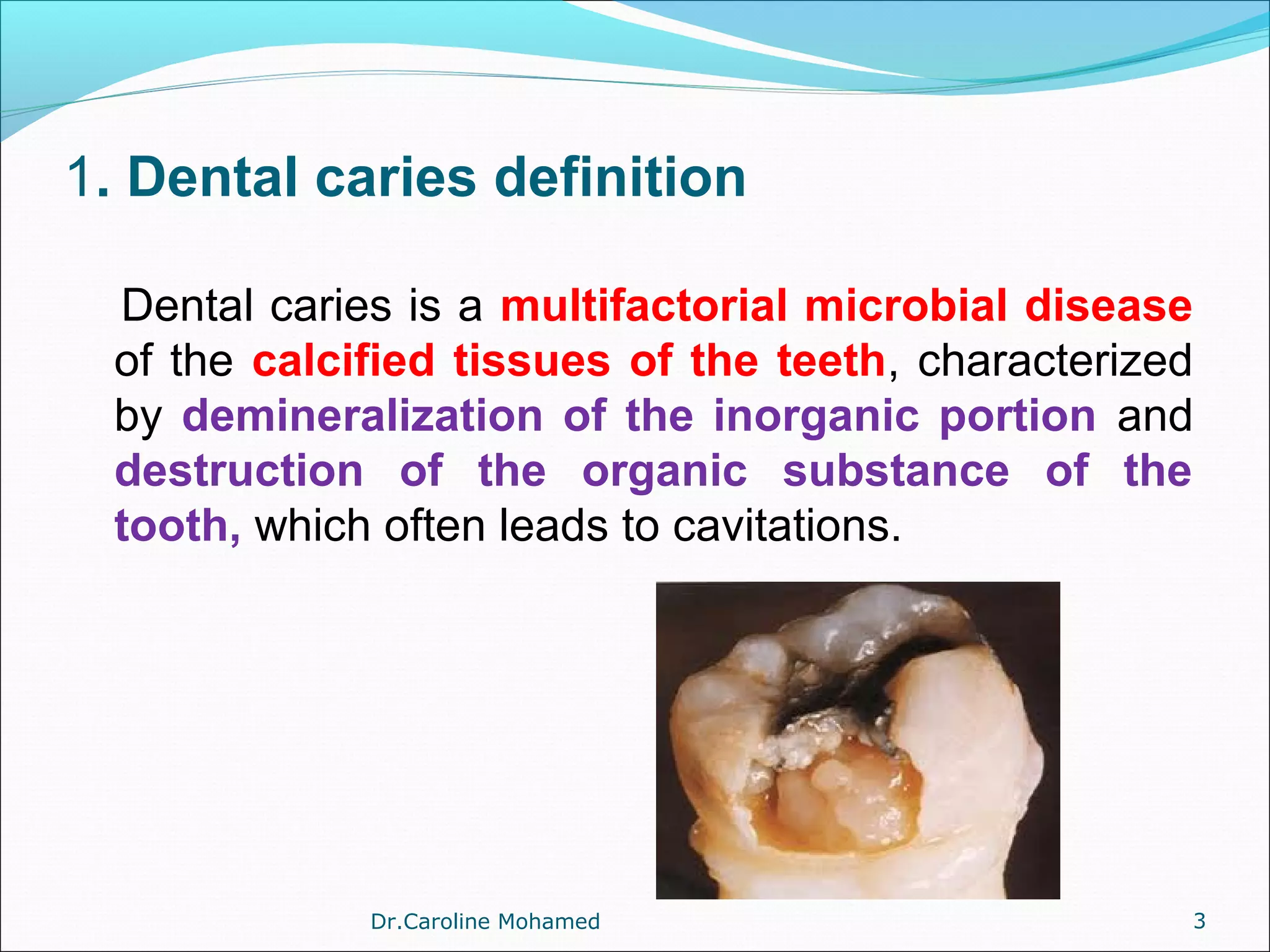 Dental caries | PPT