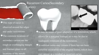 powerpoint presentation about dental caries | PPTX
