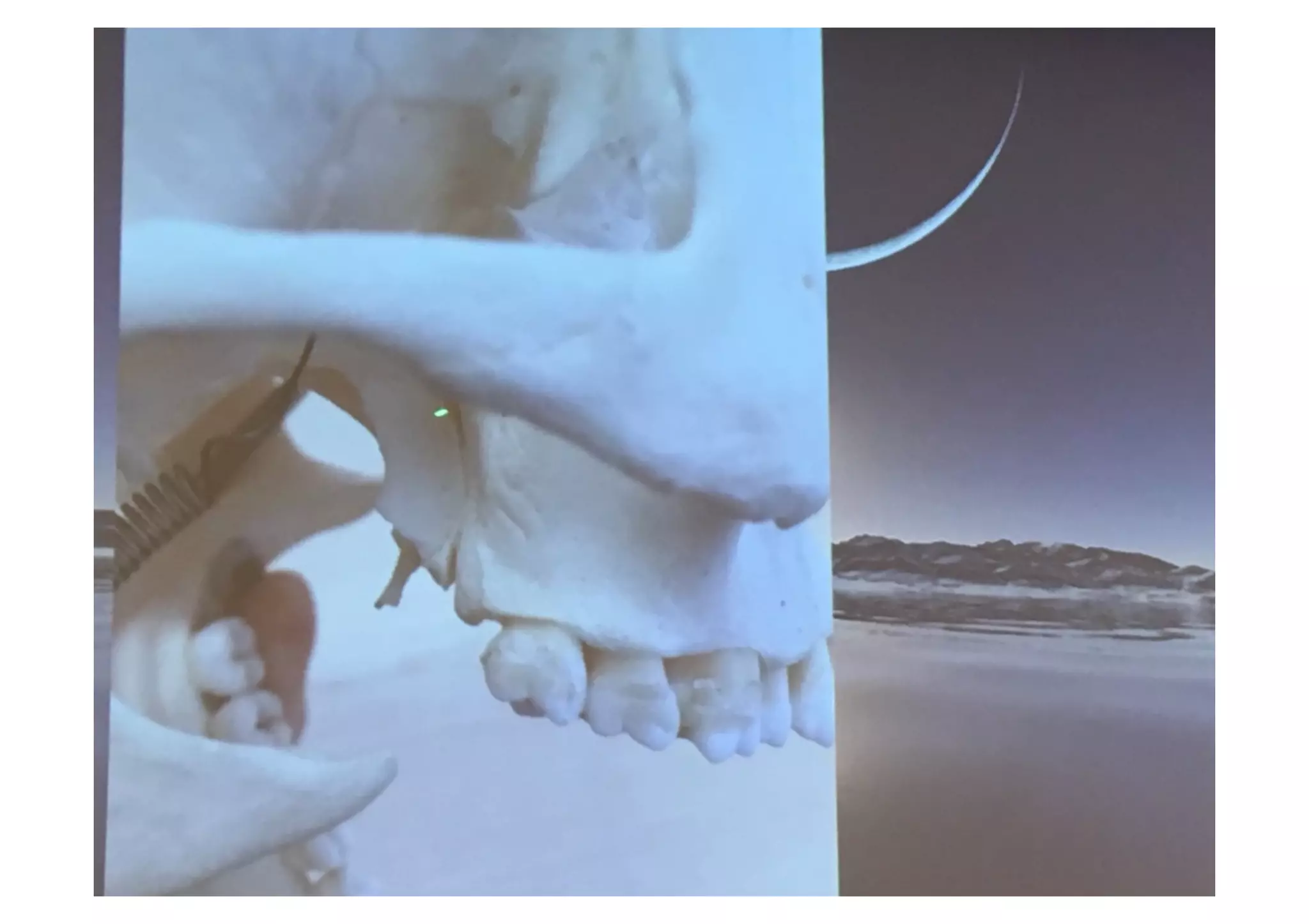 Non-Surgical Mid-Facial Expansion with Micro-Implant Assisted Maxillary ...