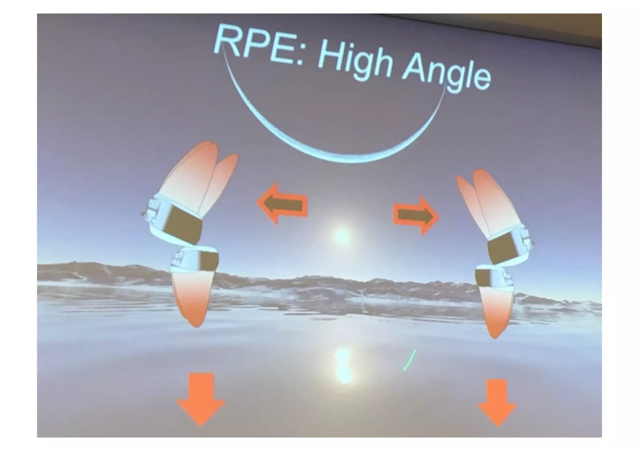 Non-Surgical Mid-Facial Expansion with Micro-Implant Assisted Maxillary ...