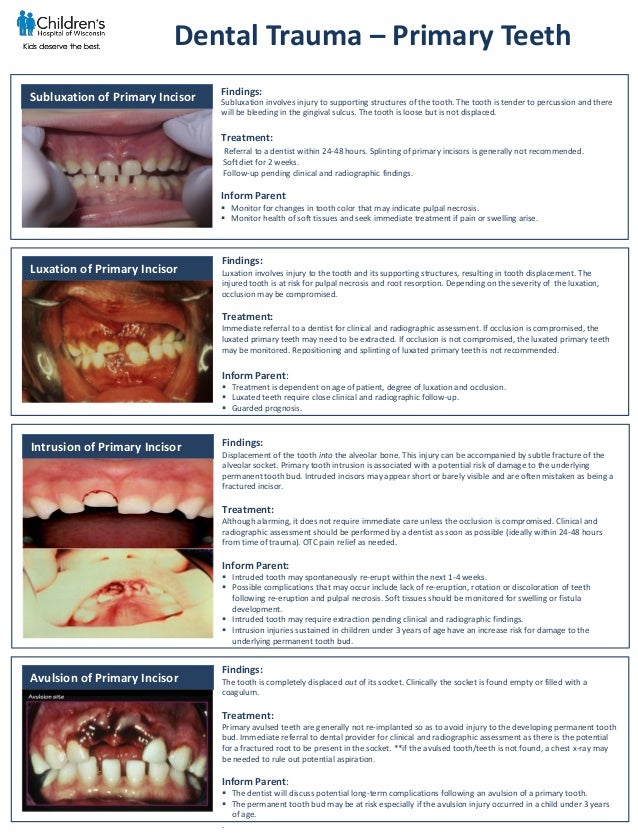 dental-trauma-flip-chart-primary.pdf