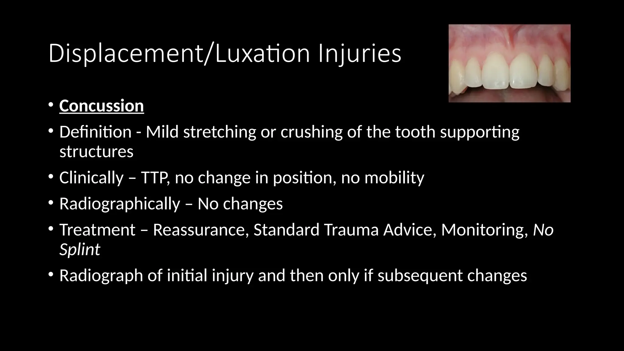 MANAGEMENT Dental-Trauma-PowerPoint.pptx