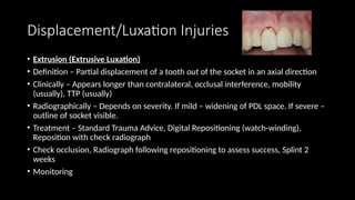 MANAGEMENT Dental-Trauma-PowerPoint.pptx