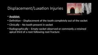 MANAGEMENT Dental-Trauma-PowerPoint.pptx