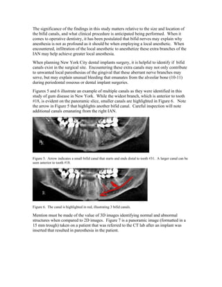 Dental 3D Cone Beam CT Imaging: Part III Bifid Canals (and other ...