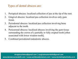 Dental Abscess | PPTX