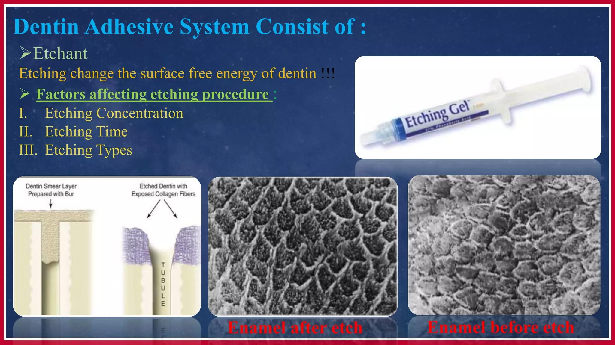Dental adhesive system | PPTX