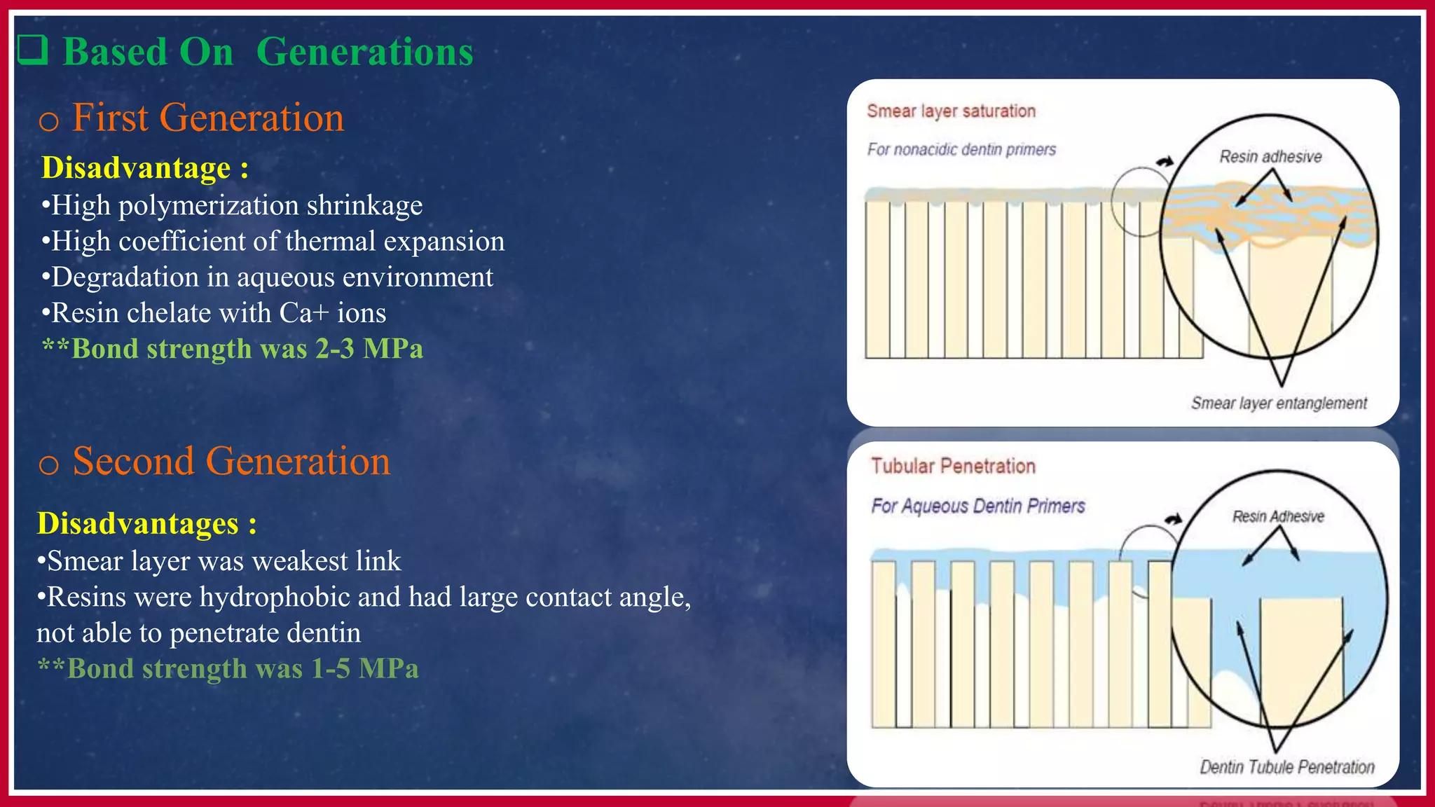 Dental adhesive system | PPTX