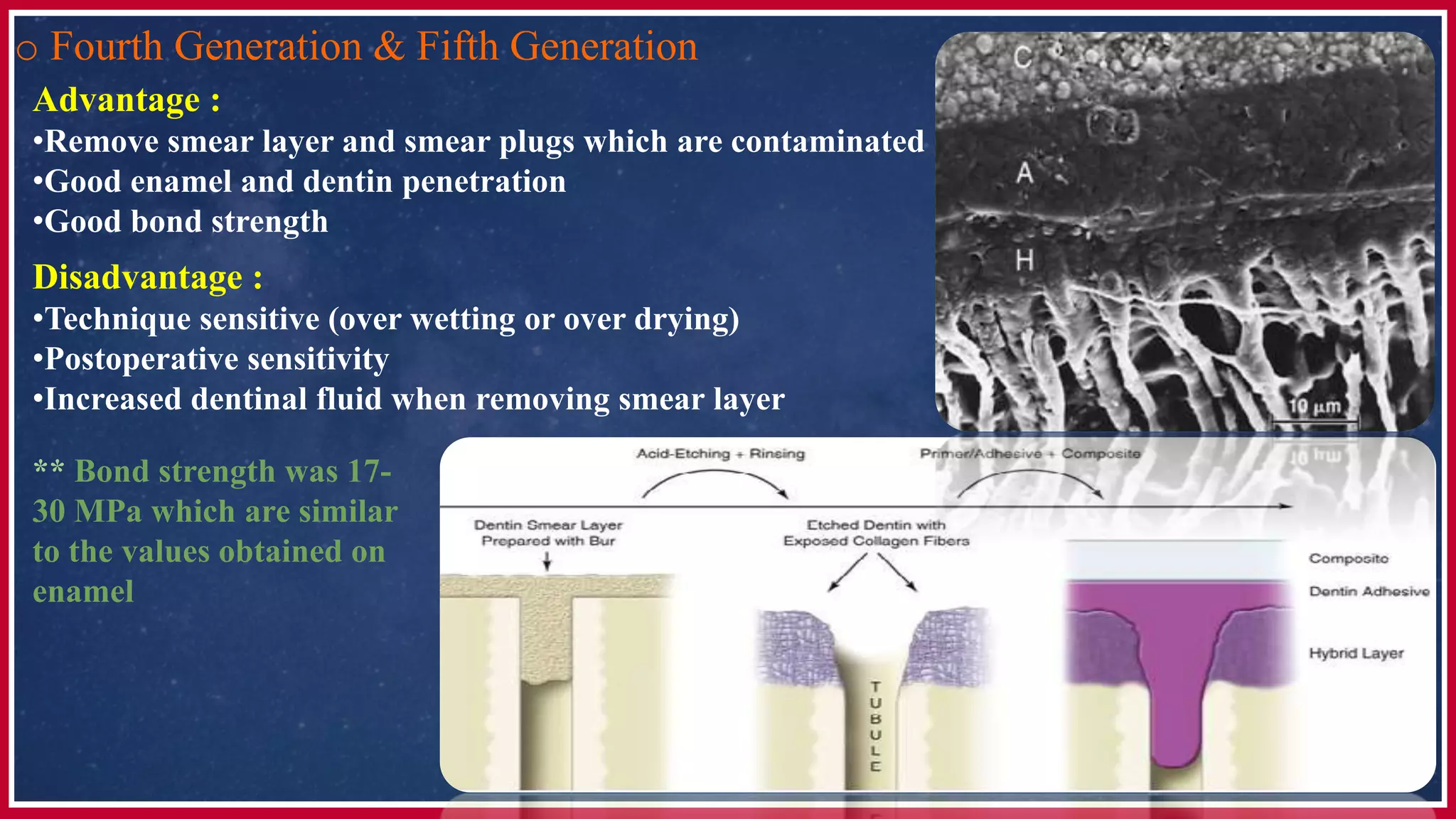 Dental adhesive system | PPTX