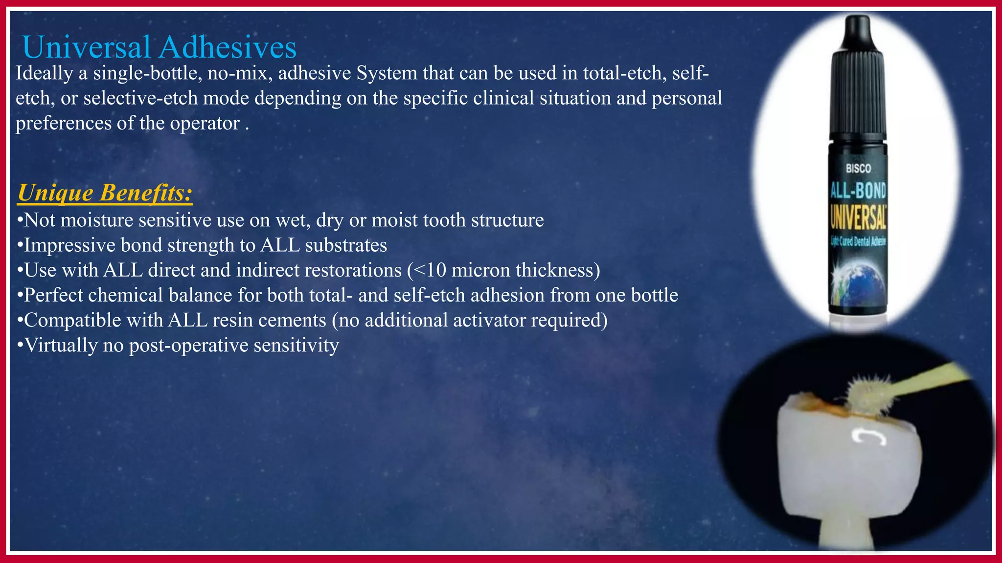 Dental adhesive system | PPTX