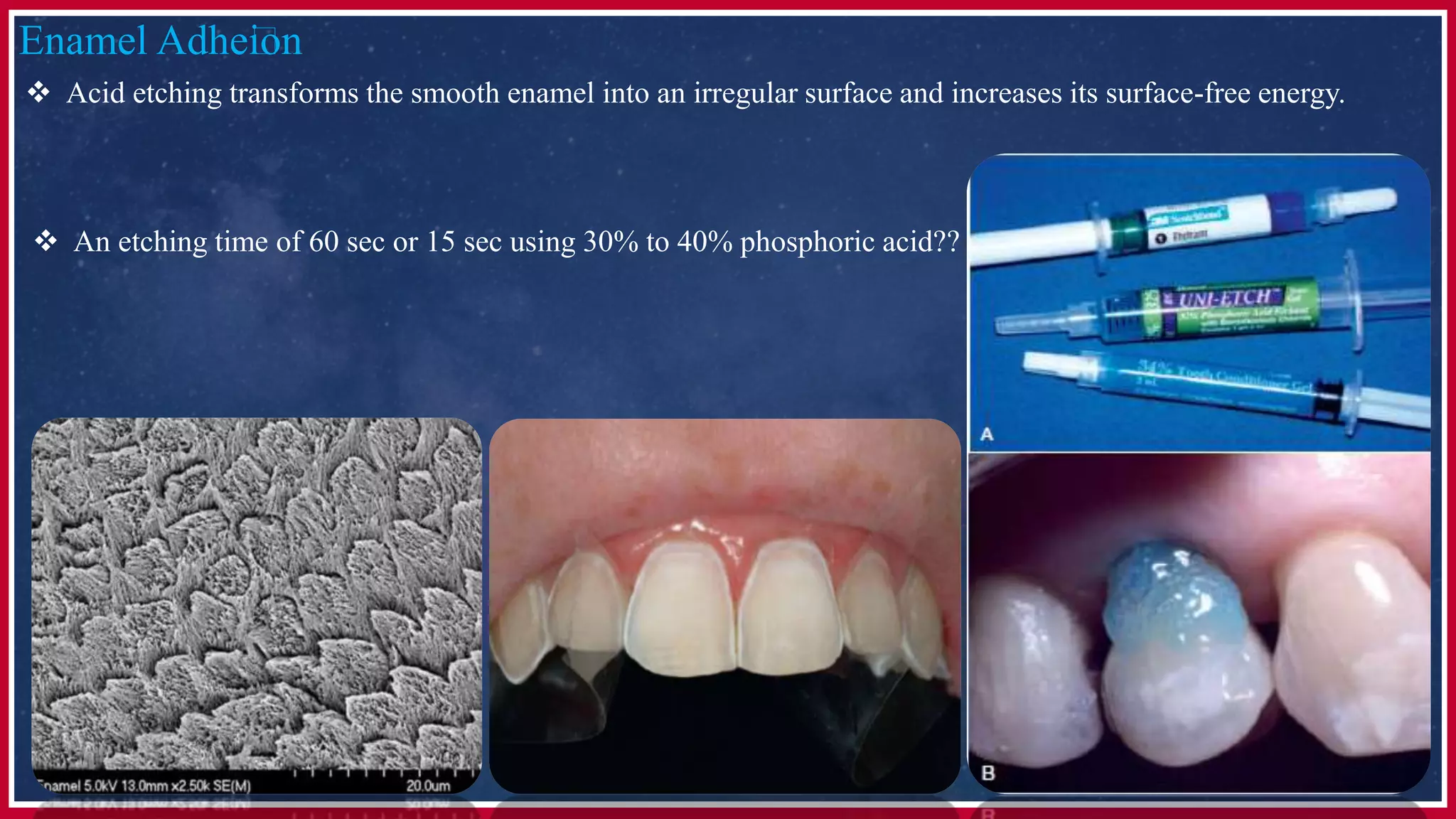 Dental adhesive system | PPTX