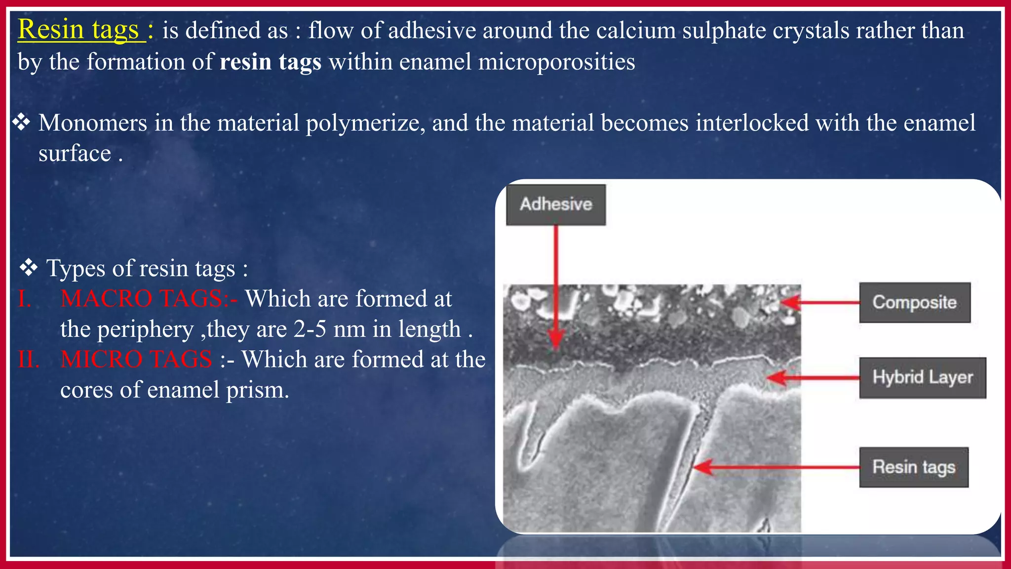 Dental adhesive system | PPTX
