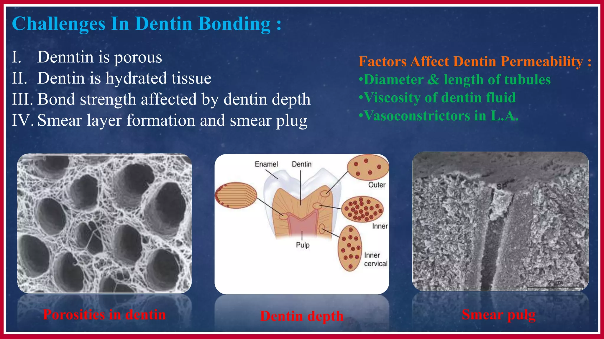 Dental adhesive system | PPTX