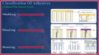 Dental adhesive system | PPTX