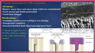 Dental adhesive system | PPTX