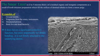 Dental adhesive system | PPTX