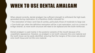 Dental amalagam | PPT