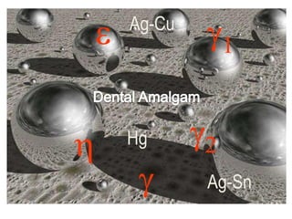 Dental Amalgam (Dental Materials Course) | PDF