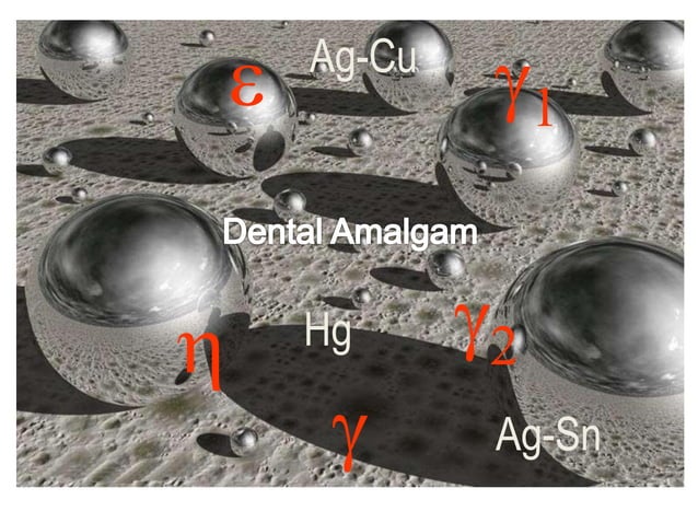 Dental Amalgam (Dental Materials Course) | PDF