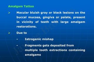 Dental Amalgam.ppt