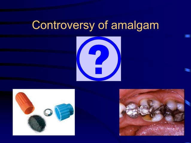 Dental amalgam - Recent advances