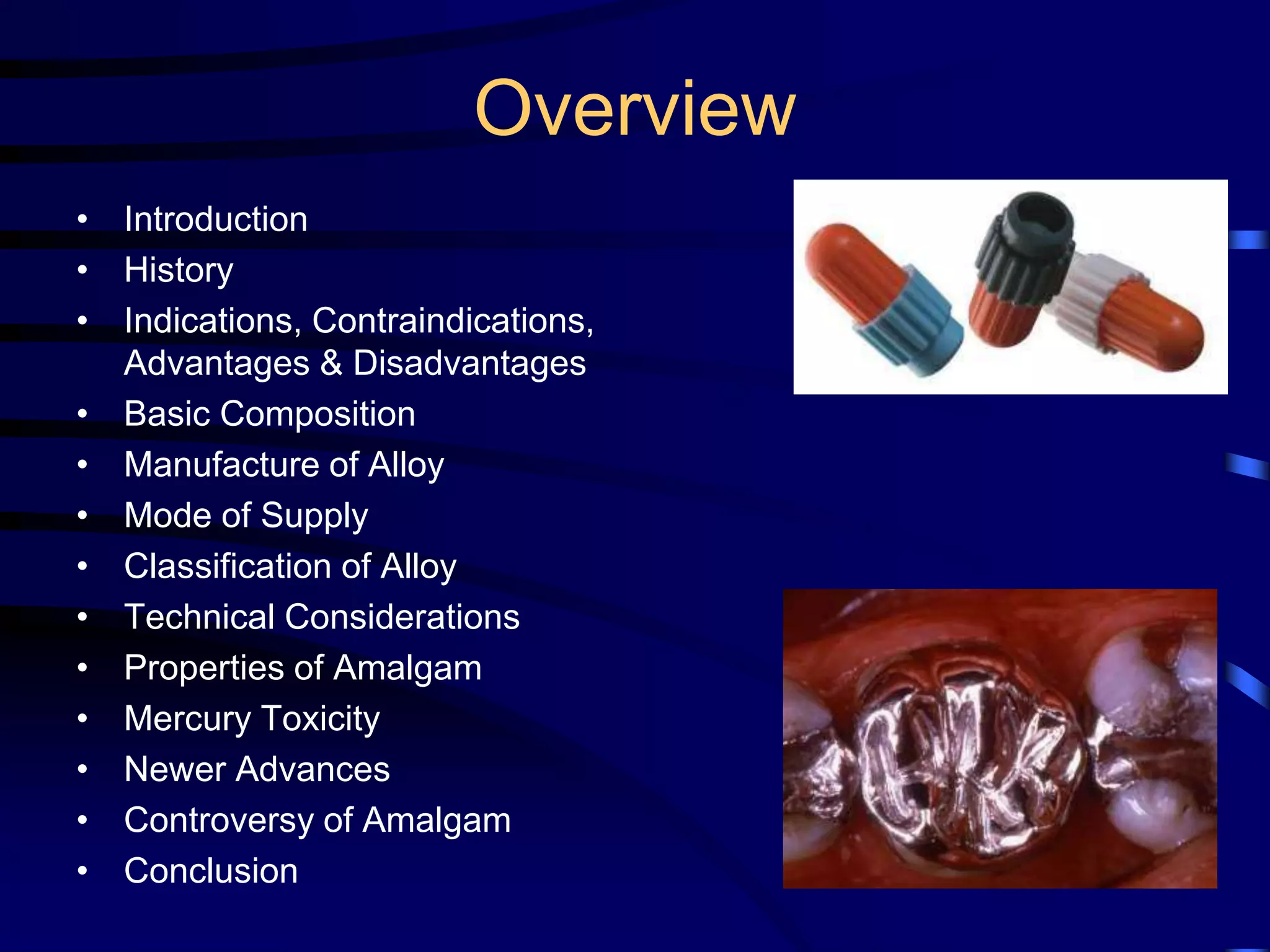Dental amalgam - Recent advances.ppt