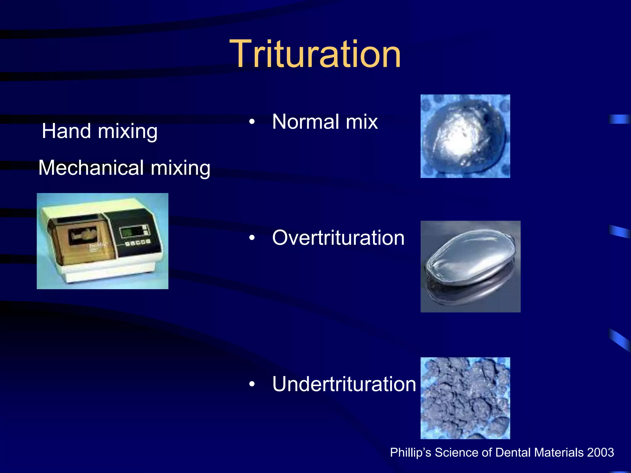 Dental amalgam - Recent advances.ppt