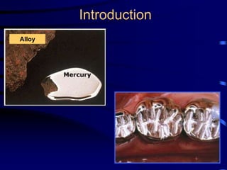 Dental amalgam - Recent advances.ppt