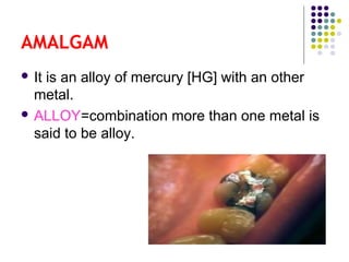 Dental amalgam | PPT