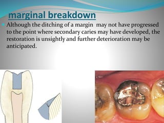 Dental amalgam power point by Dr.Kazhan O. Abdulrahman | PPTX