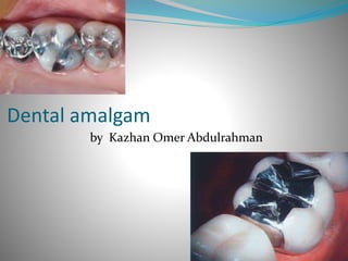 Dental amalgam power point by Dr.Kazhan O. Abdulrahman | PPT