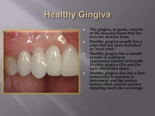 Oral Anatomy | PPTX