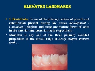 Introduction and nomenclature of dental anatomy | PPTX