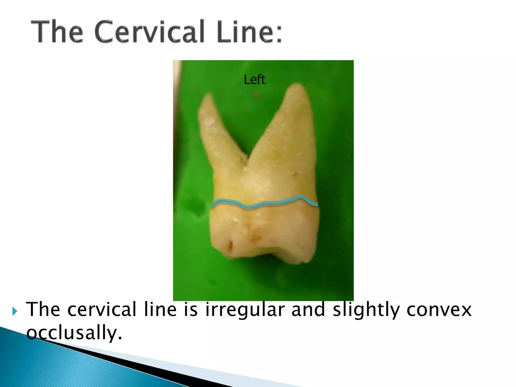 Dental anatomy,max.first molar | PPT