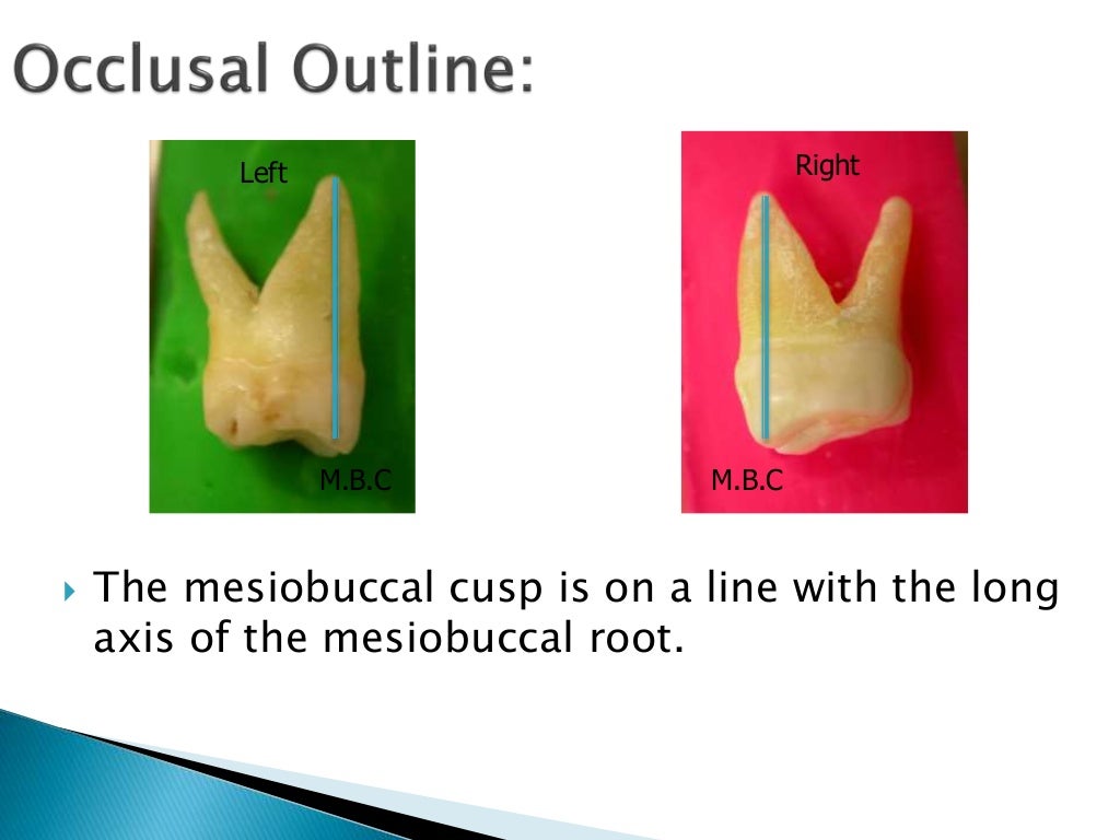 Dental anatomy,max.first molar