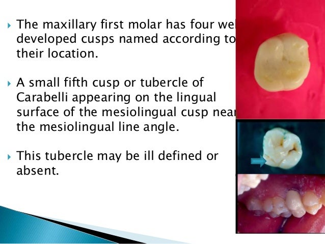 Dental anatomy,max.first molar